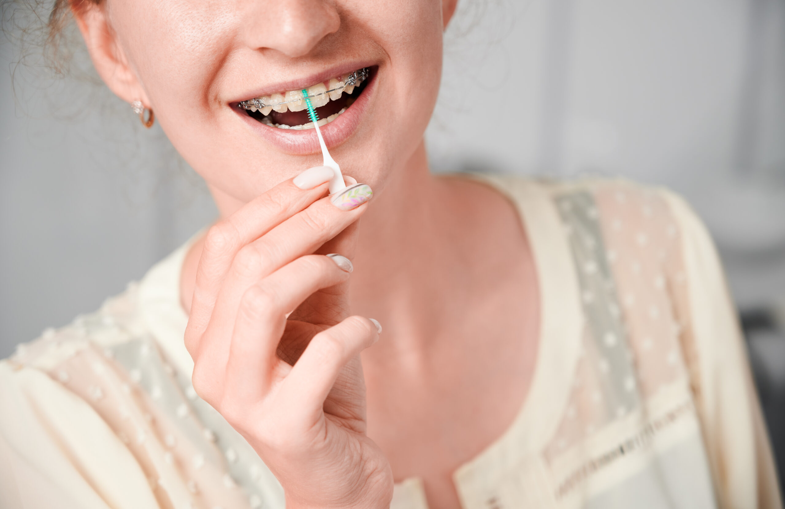 How to Clean Your Braces or Invisalign Trays Like a Pro - Ello Orthodontics